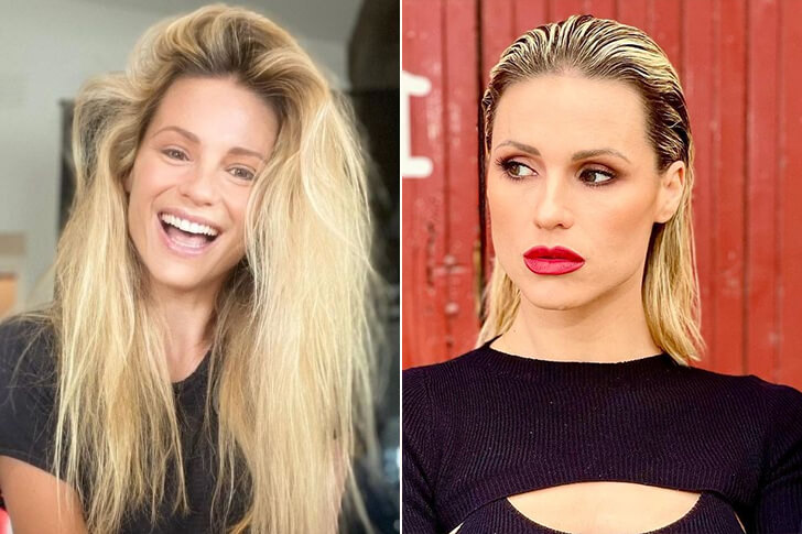 Voller Stolz und Selbstbewusstsein - Diese Promis zeigen sich ohne Make ...