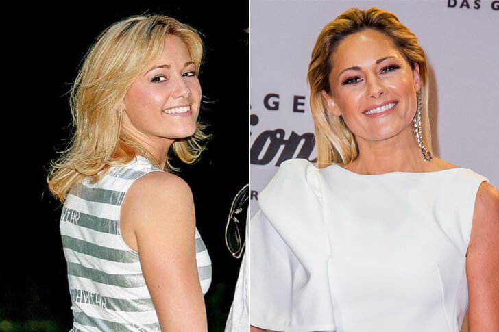 Voller Stolz und Selbstbewusstsein - Diese Promis zeigen sich ohne Make ...