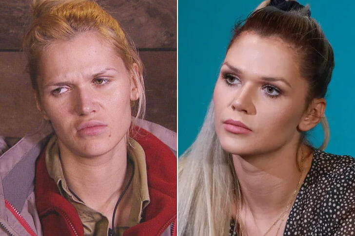 Voller Stolz und Selbstbewusstsein - Diese Promis zeigen sich ohne Make ...